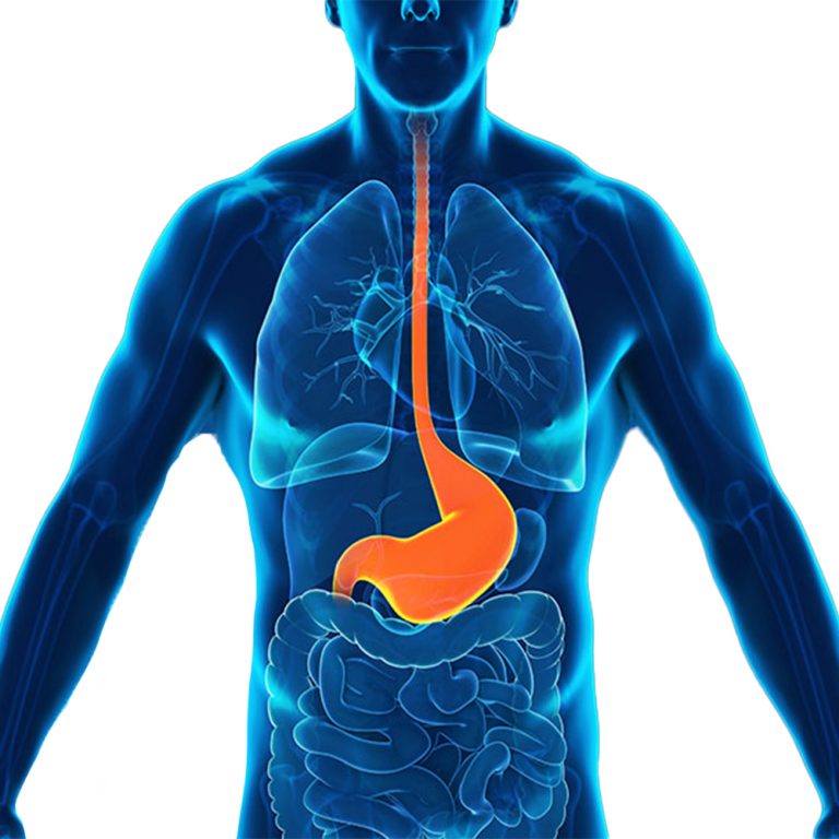 Reflujo Gastroesofágico, estrategias para combatirlo - Gastrum
